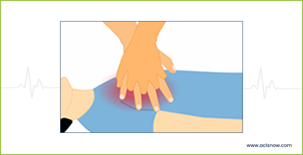 CPR Guide: Ideal Depth & Rate for Chest Compressions
