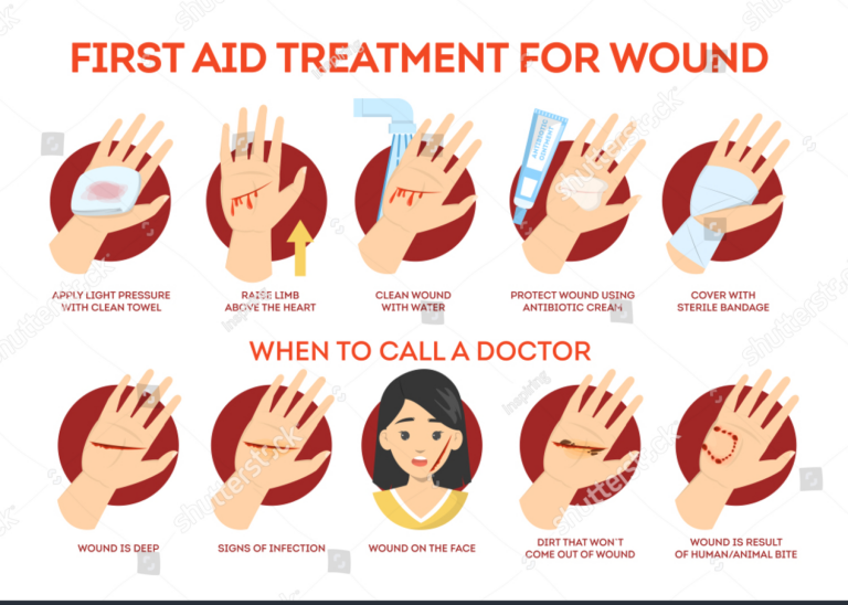 Recognising the Types of Bleeding: A First Aid Guide